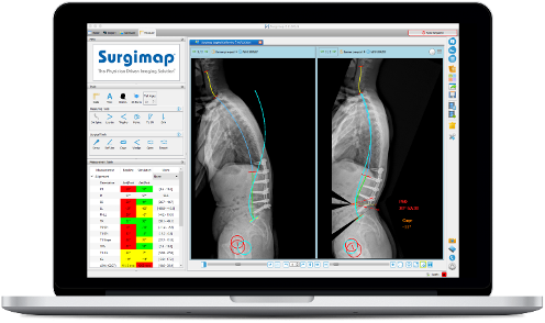 Download Surgimap - Surgimap.com: Official Site for Surgimap