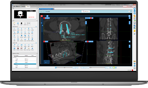 Download Surgimap - Surgimap.com: Official Site for Surgimap